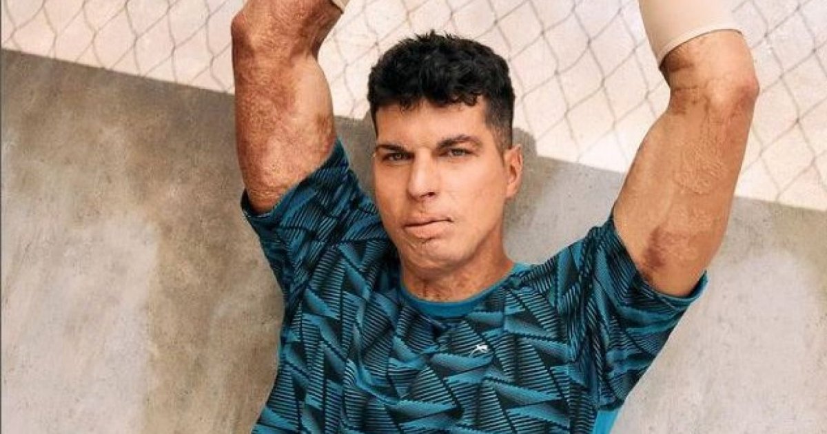 Ignacio Lastra recordó el grave accidente en el que terminó con 90% de ...